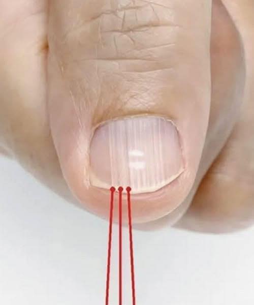 Understanding The Real Causes Of Vertical Ridges On Your Nails Zepnews