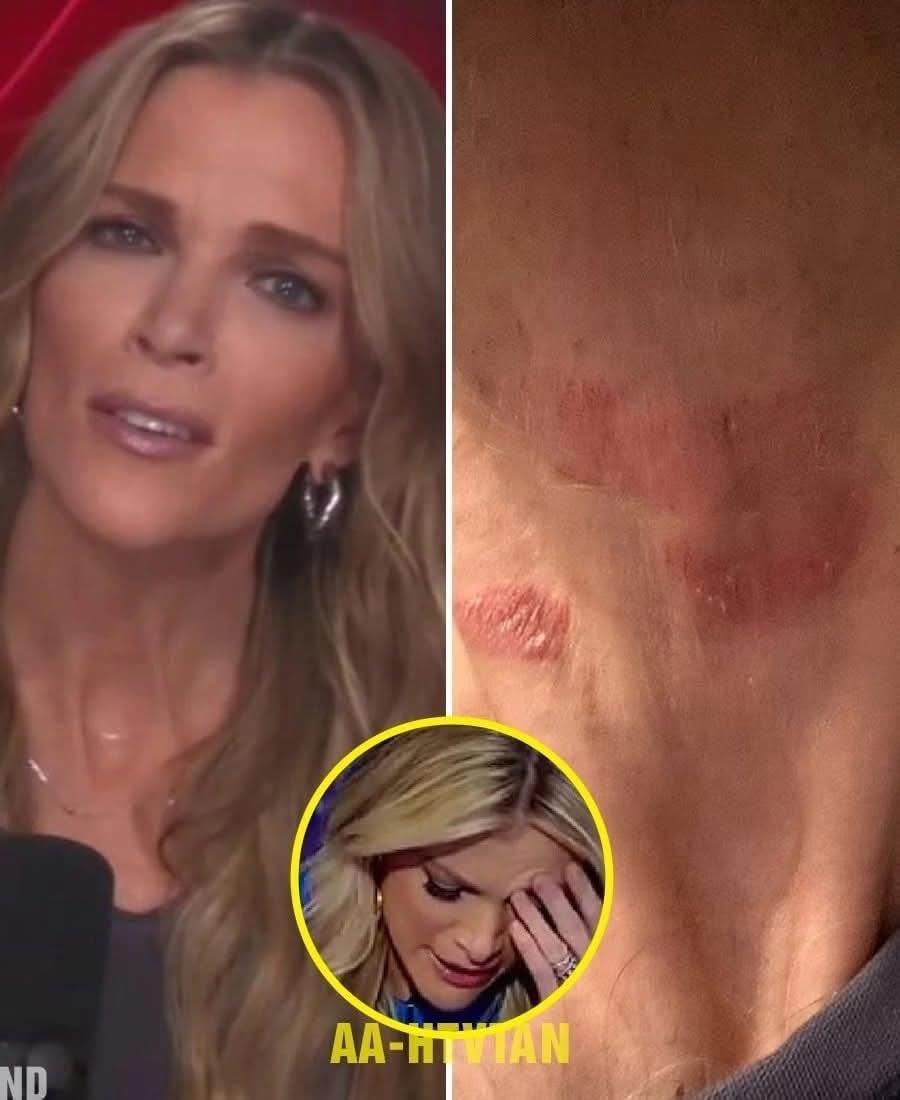 Megyn Kelly Hospitalized in Critical Condition… See more – ZepNews
